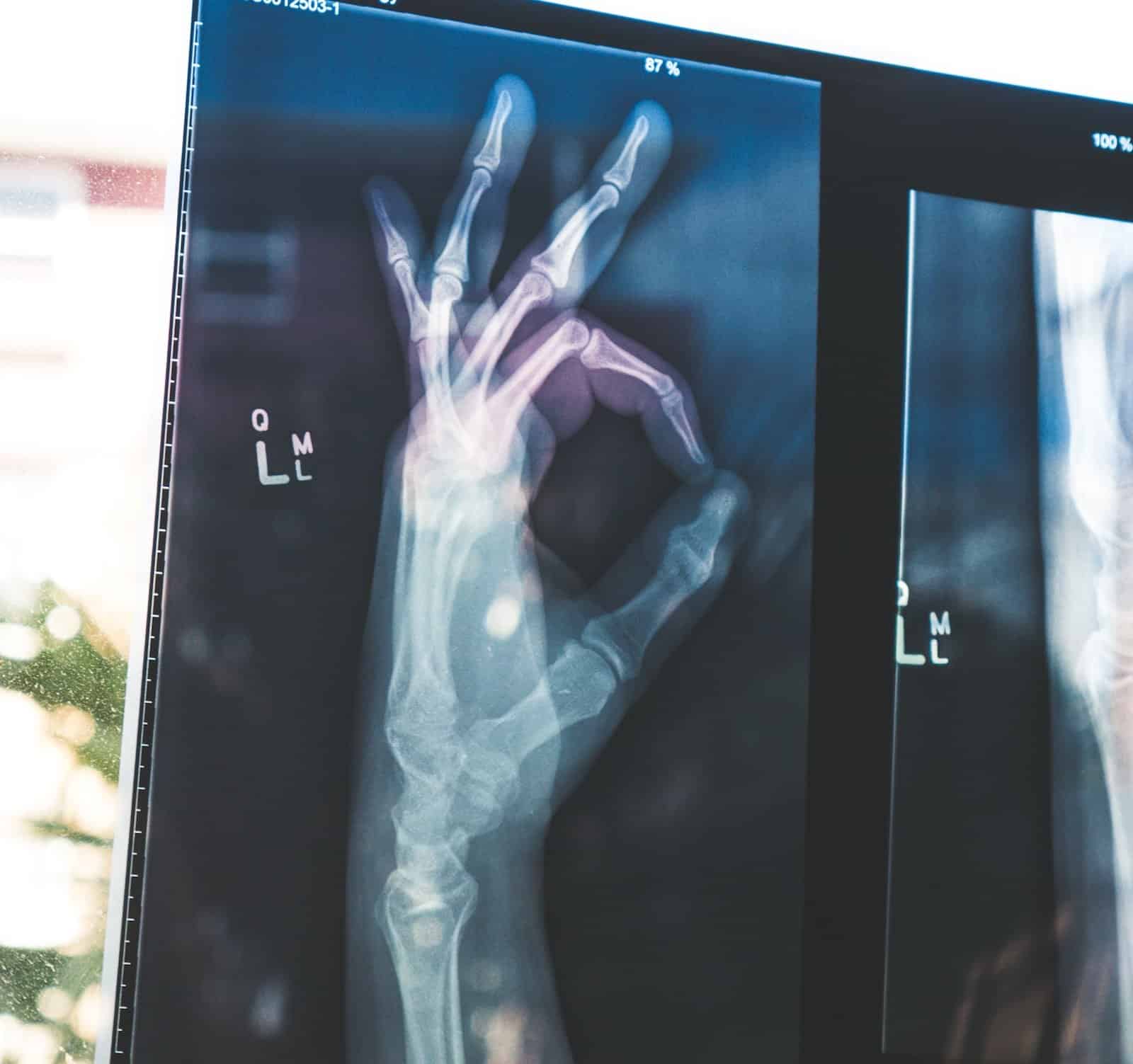 Protected Health Information - All You Need To Know - ITChronicles